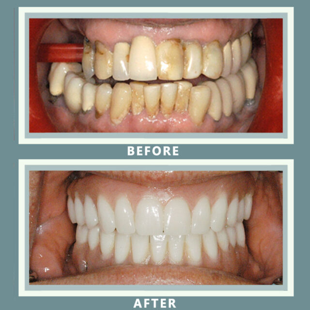 Free Dental Implant Evaluation - Mobile - Sedation and Implant Dentists