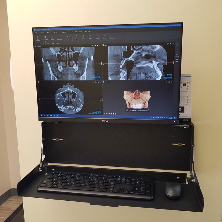 State of the Art Technology - Sedation and Implant Dentists